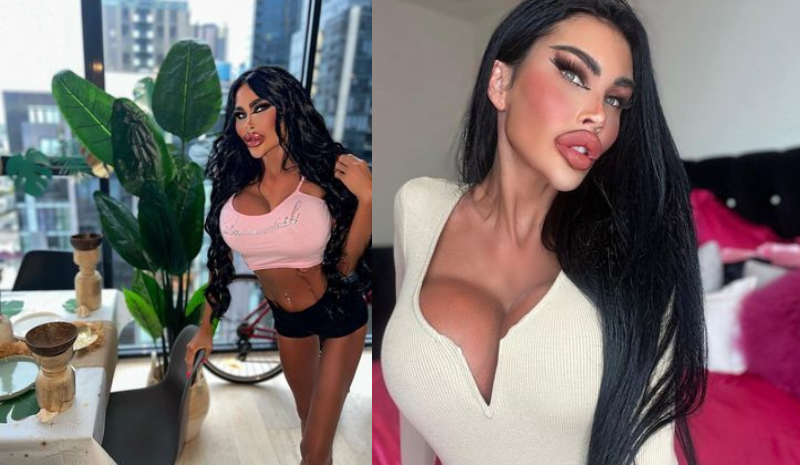 ‘Barbie Humana’ australiana já gastou mais de R$ 700 mil em cirurgias para ter visual extremo